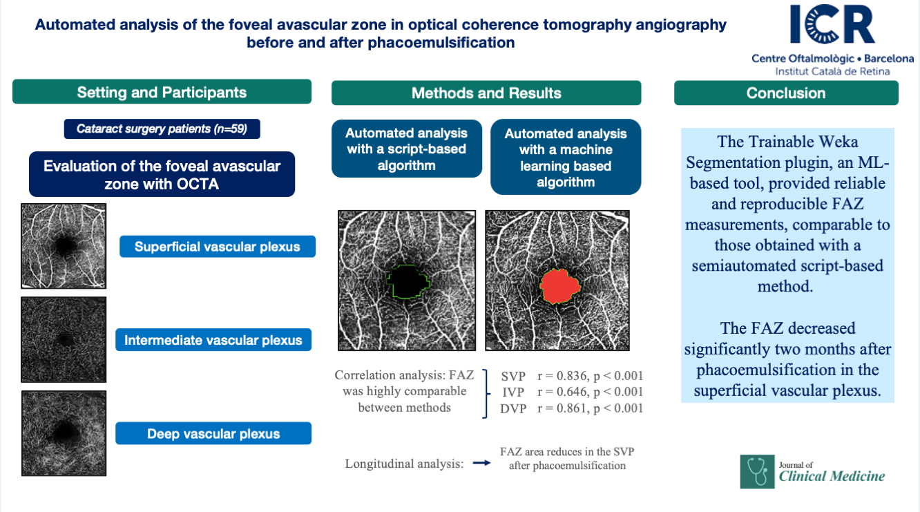 Automated Analysis of the Foveal Avascular Zone in Optical Coherence Tomography Angiography ...