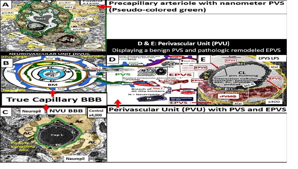 A Closer Look at the Perivascular Unit in the Development of Enlarged ...
