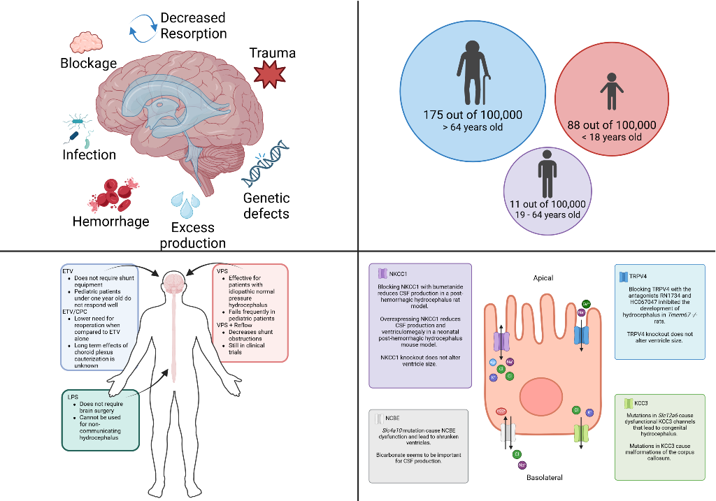 Understanding and Modeling the Pathophysiology of Hydrocephalus: In ...