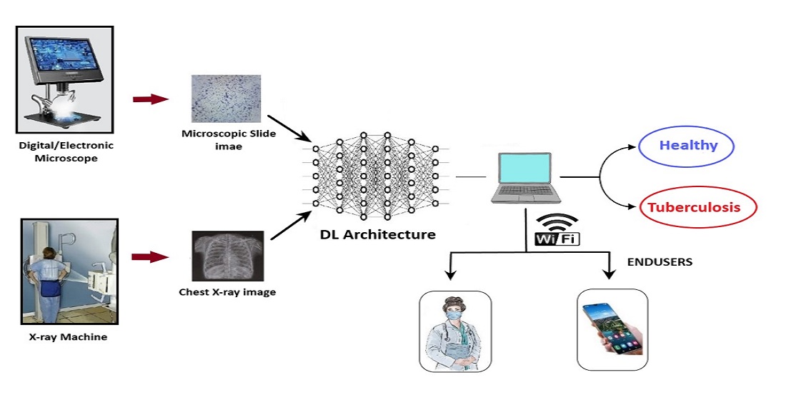 Artificial Intelligent-Powered Detection of Tuberculosis[v1] | Preprints.org
