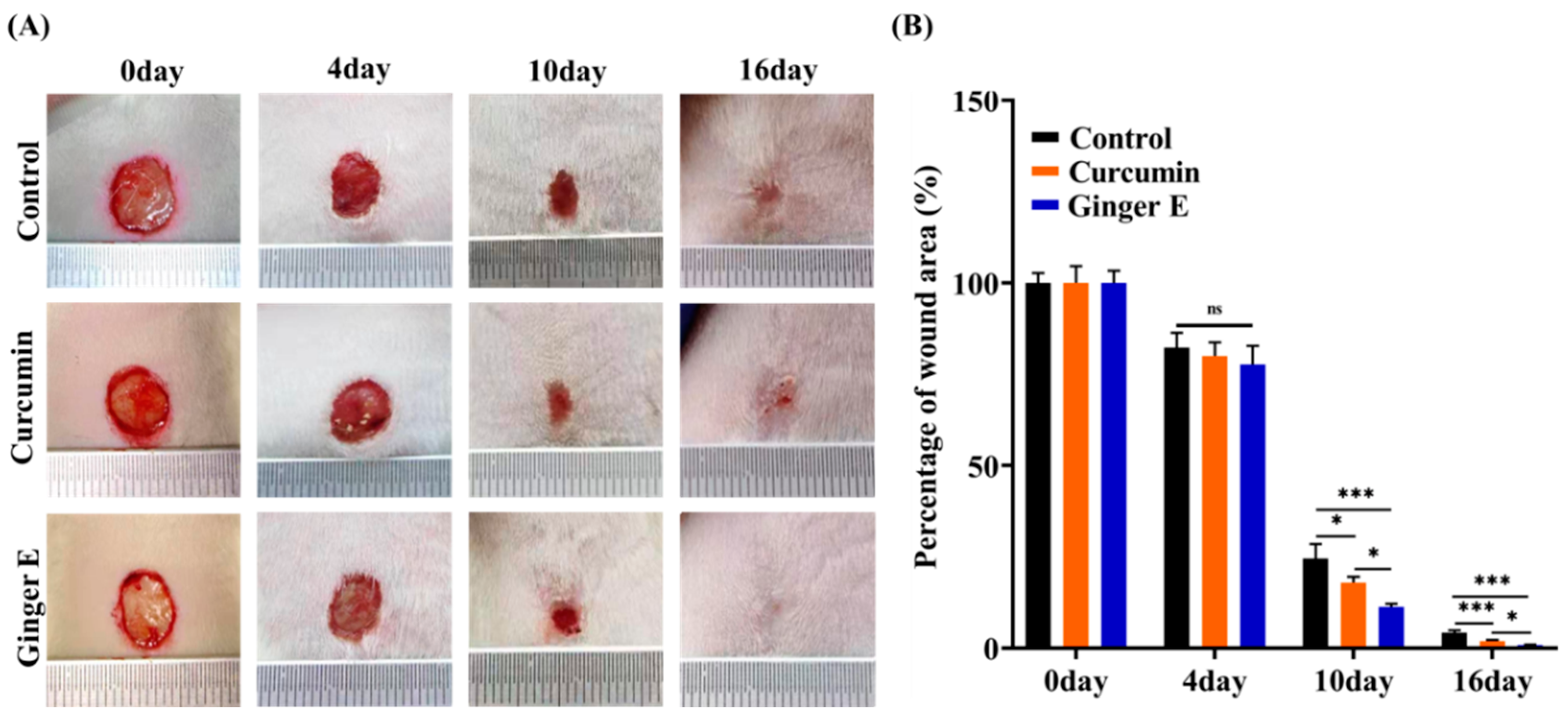 Natural Ginger Extract Versus Curcumin: Who Has Better Antioxidant and ...