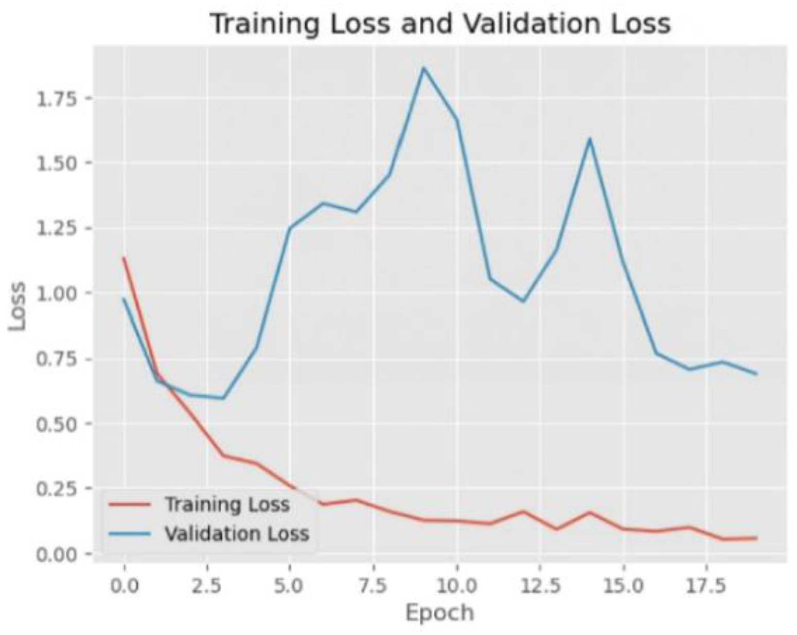 Deep Learning Models for Multi-Class Pneumonia Detection in Chest X ...