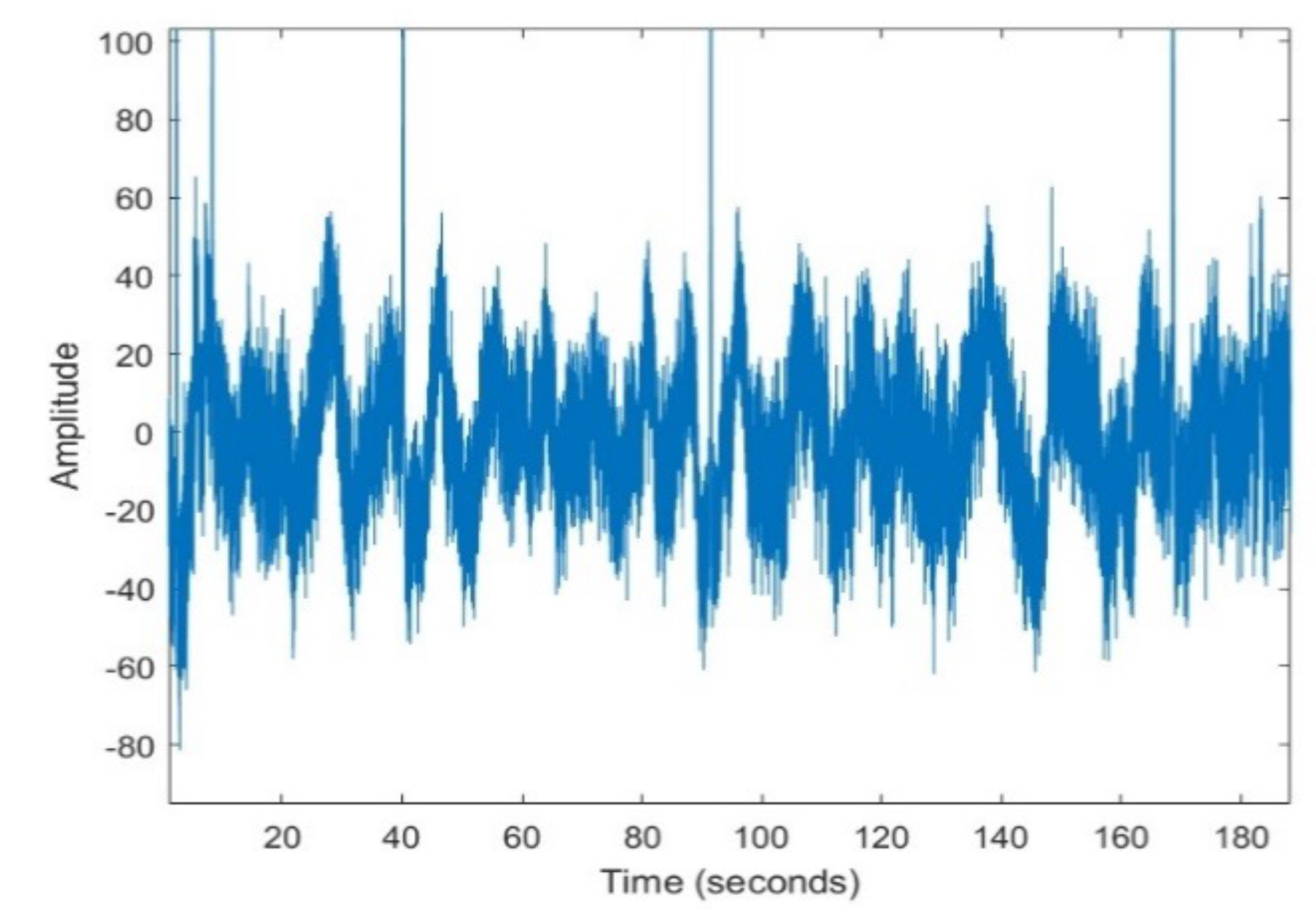 Non-Linear Synthetic Time Series Generation for EEG Data Using LSTM ...