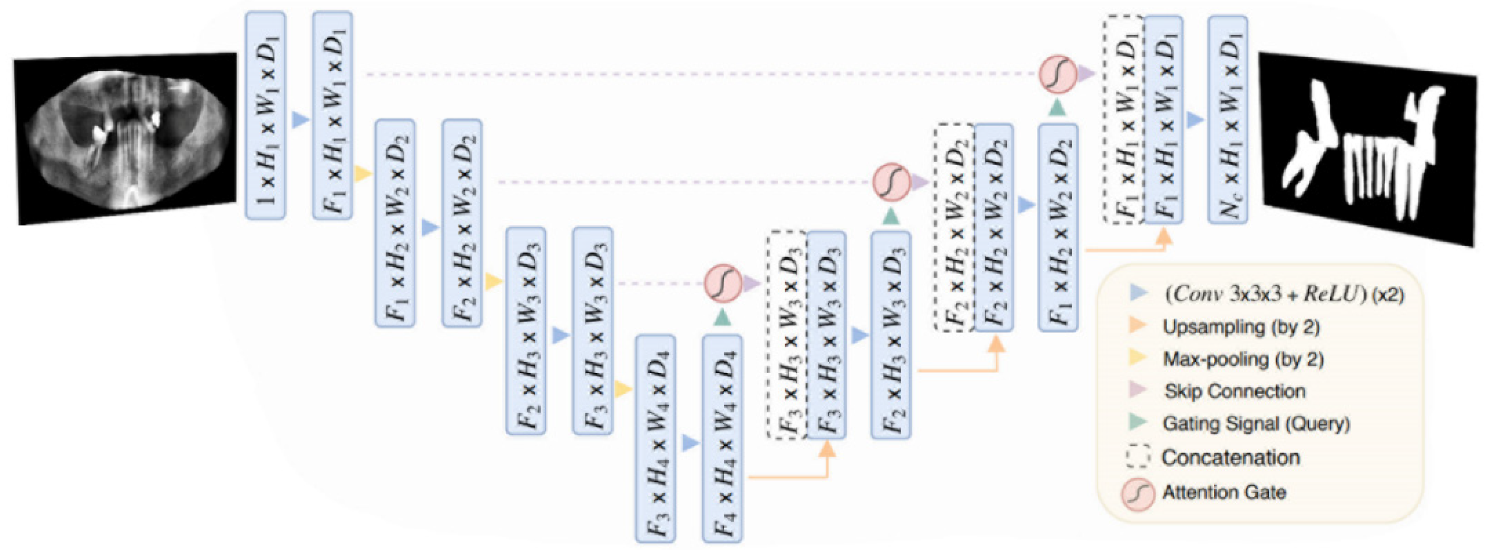 Automatic Teeth Segmentation Using Attention U-Net[v1] | Preprints.org