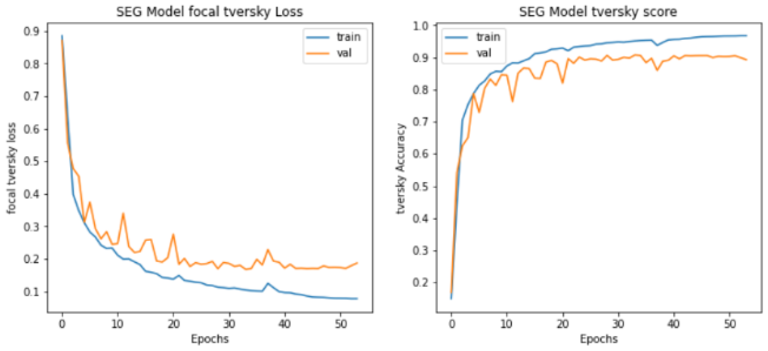 Head Tumor Segmentation and Detection Based on Resunet[v1] | Preprints.org