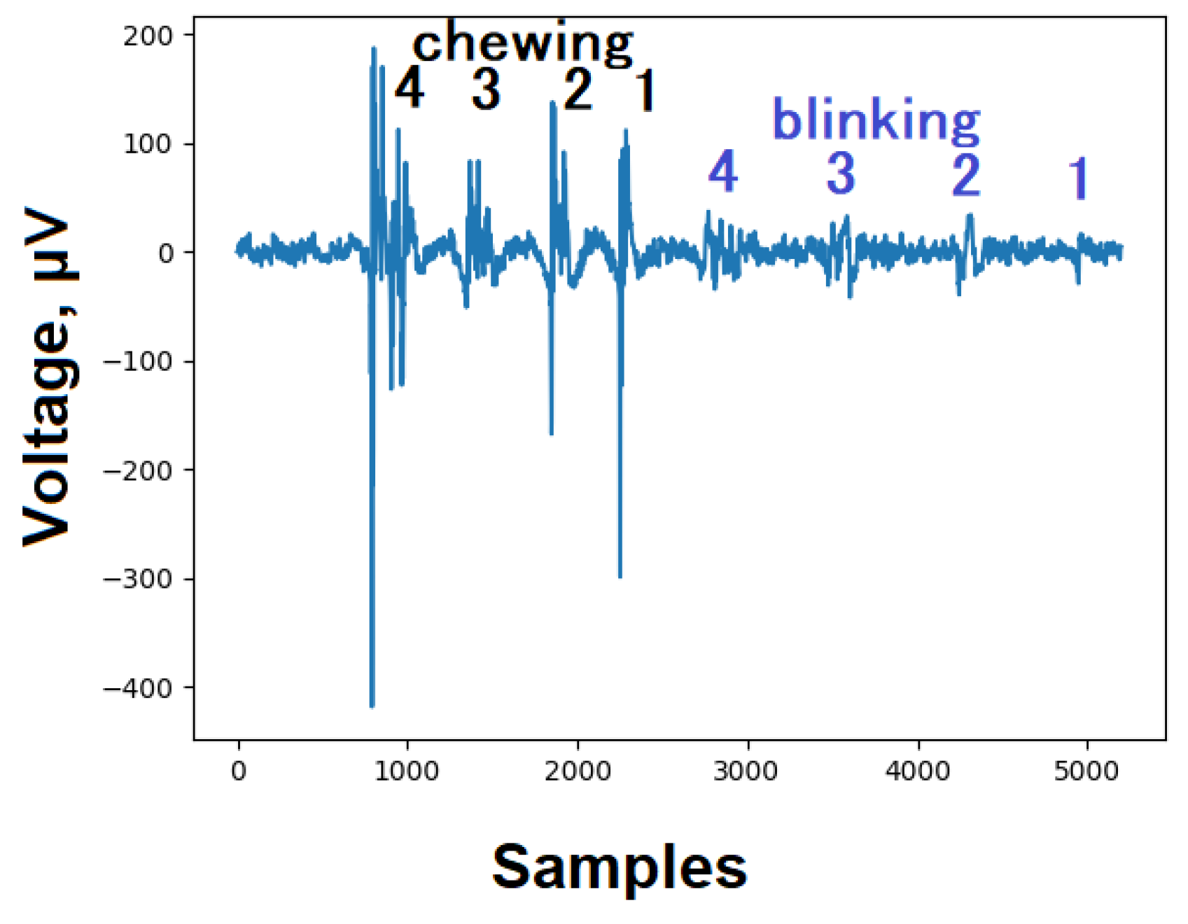 Low-Cost Shield ardEEG to Measure EEG with Arduino Uno R4 WiFi[v1] | Preprints.org