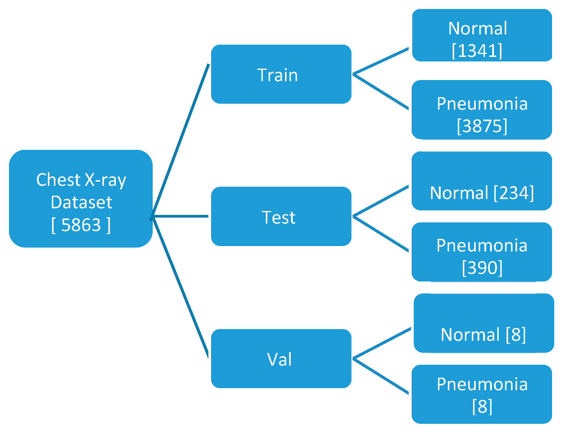 Pneumonia Detection from Chest X-rays Using the CheXNet Deep Learning ...
