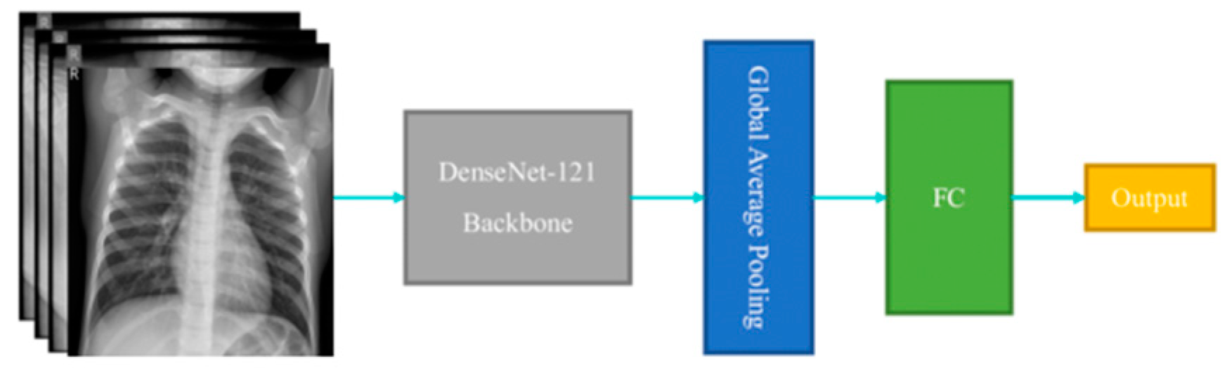 Pneumonia Detection from Chest X-rays Using the CheXNet Deep Learning Algorithm[v1] | Preprints.org