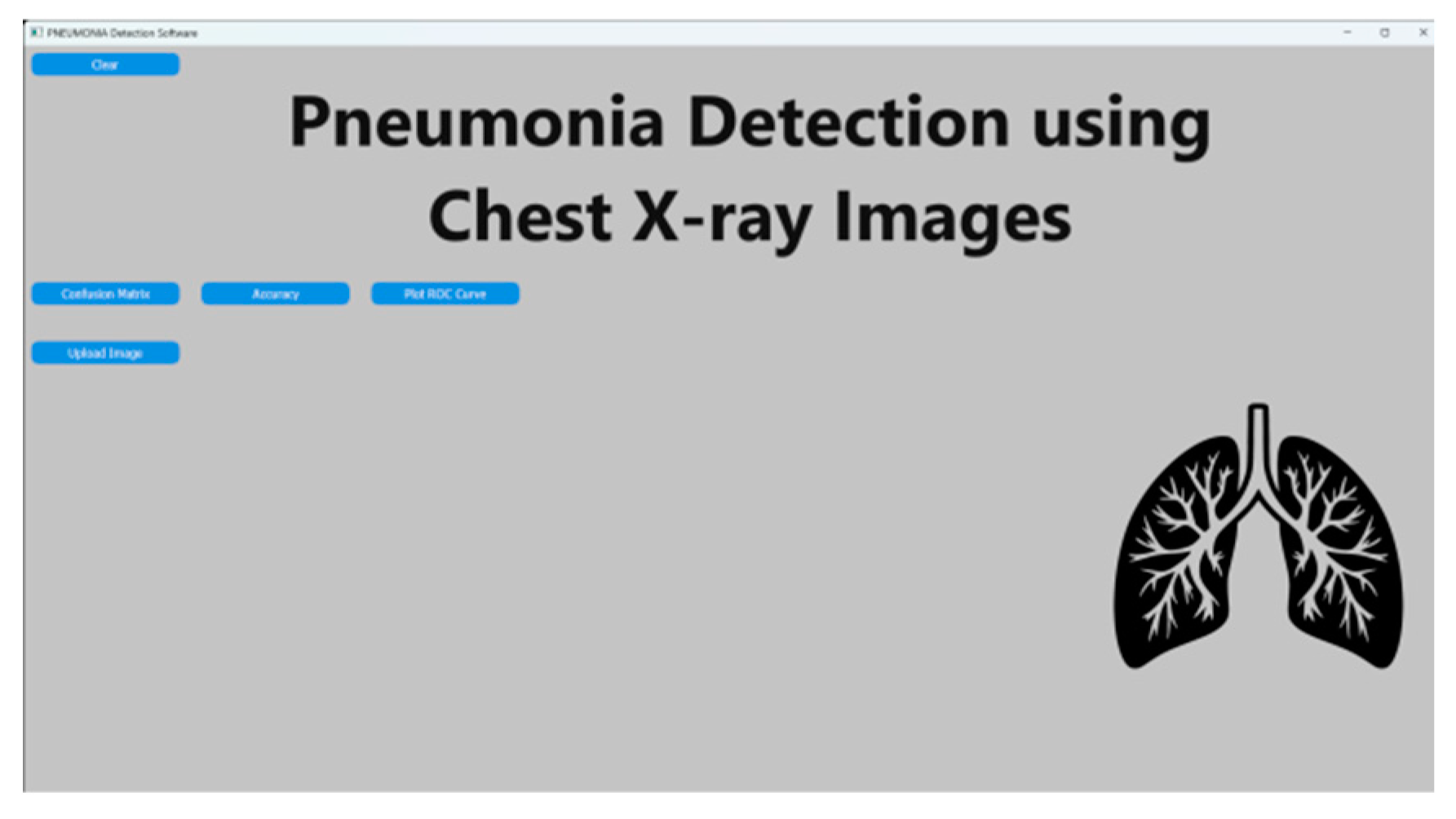Pneumonia Detection from Chest X-rays Using the CheXNet Deep Learning ...