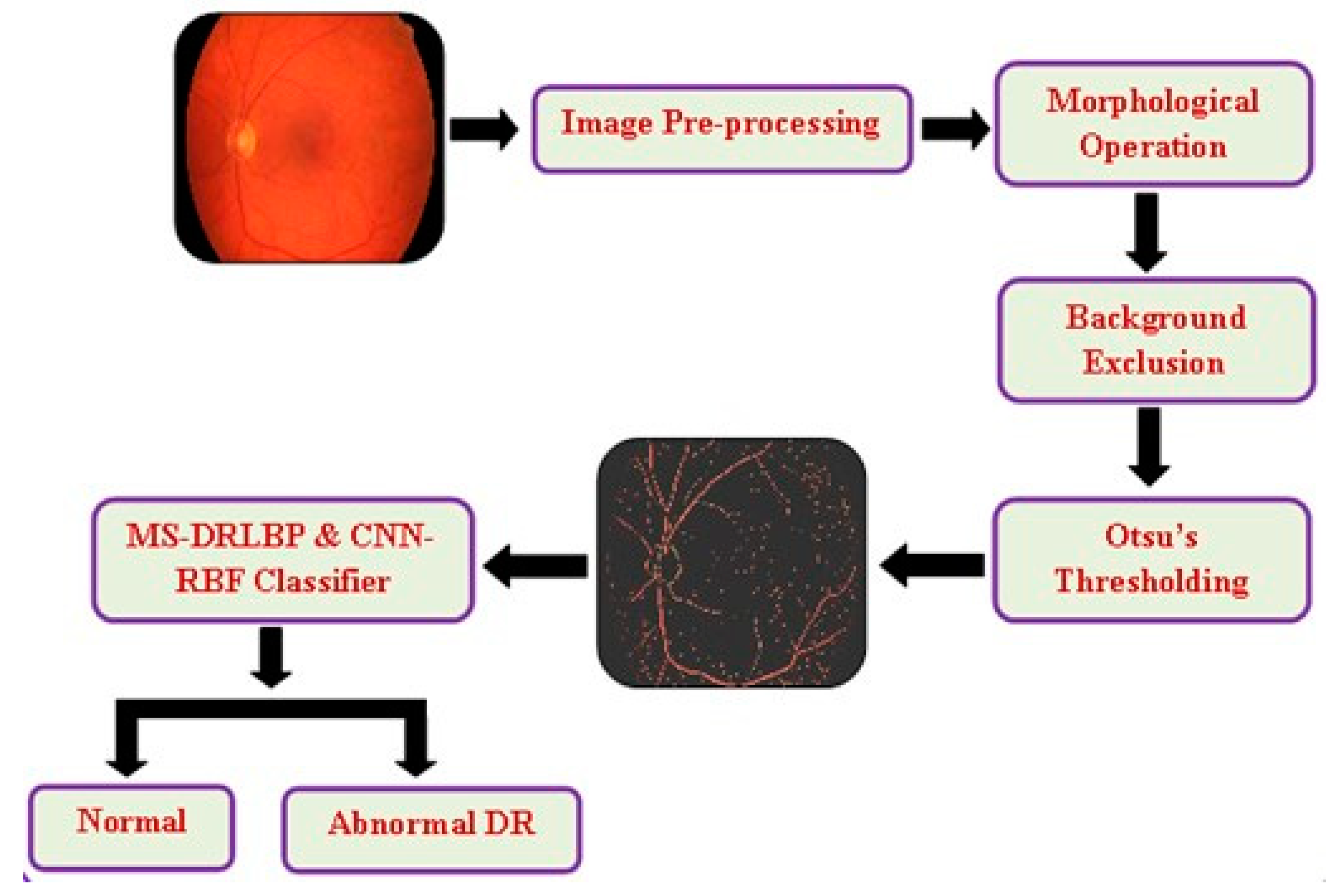 Advanced Detection of Diabetic Retinopathy: Employing Hybrid Deep ...