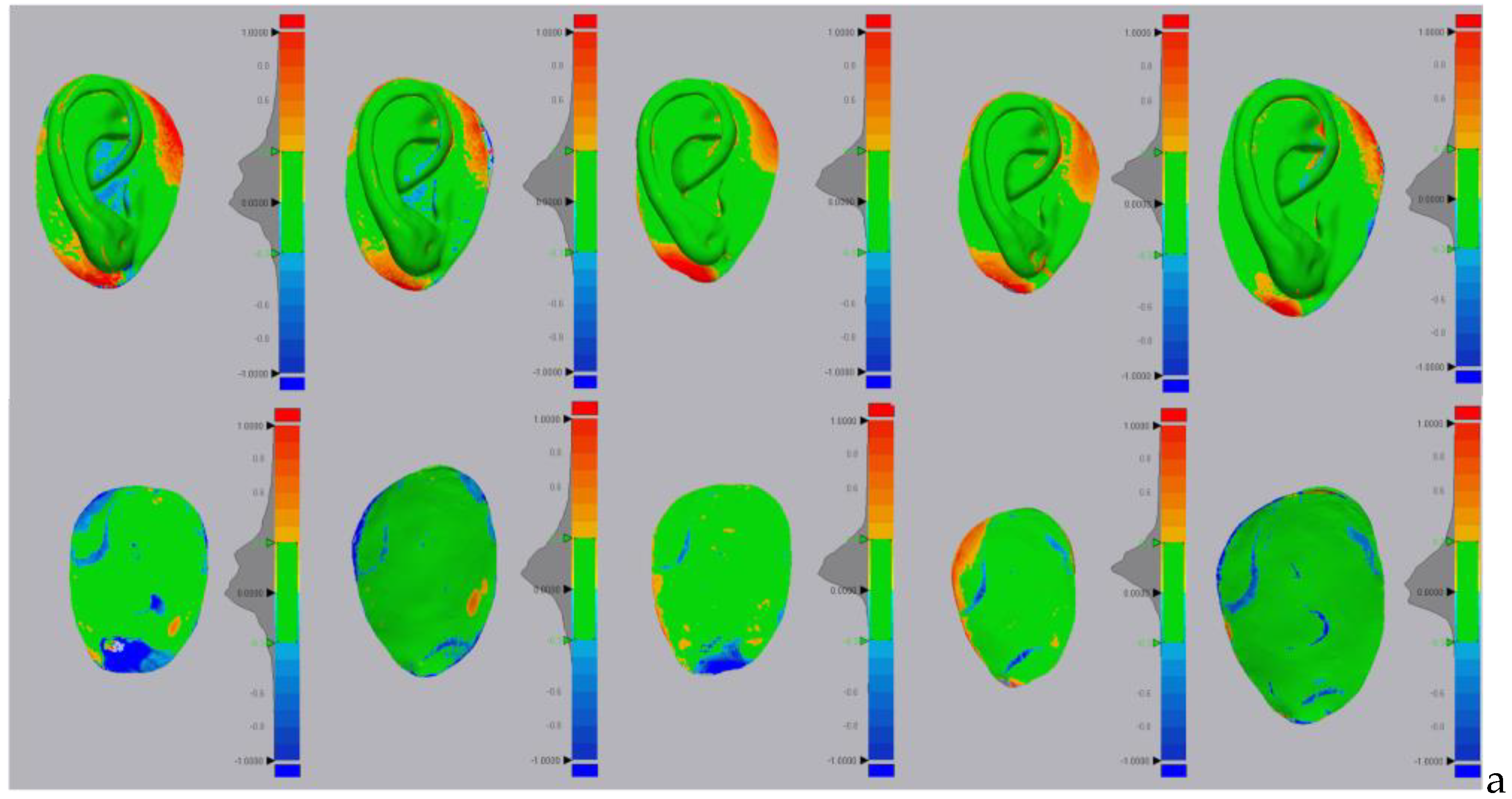 A Hybrid Workflow for Auricular Epithesis: Proof of Concept Integrating ...