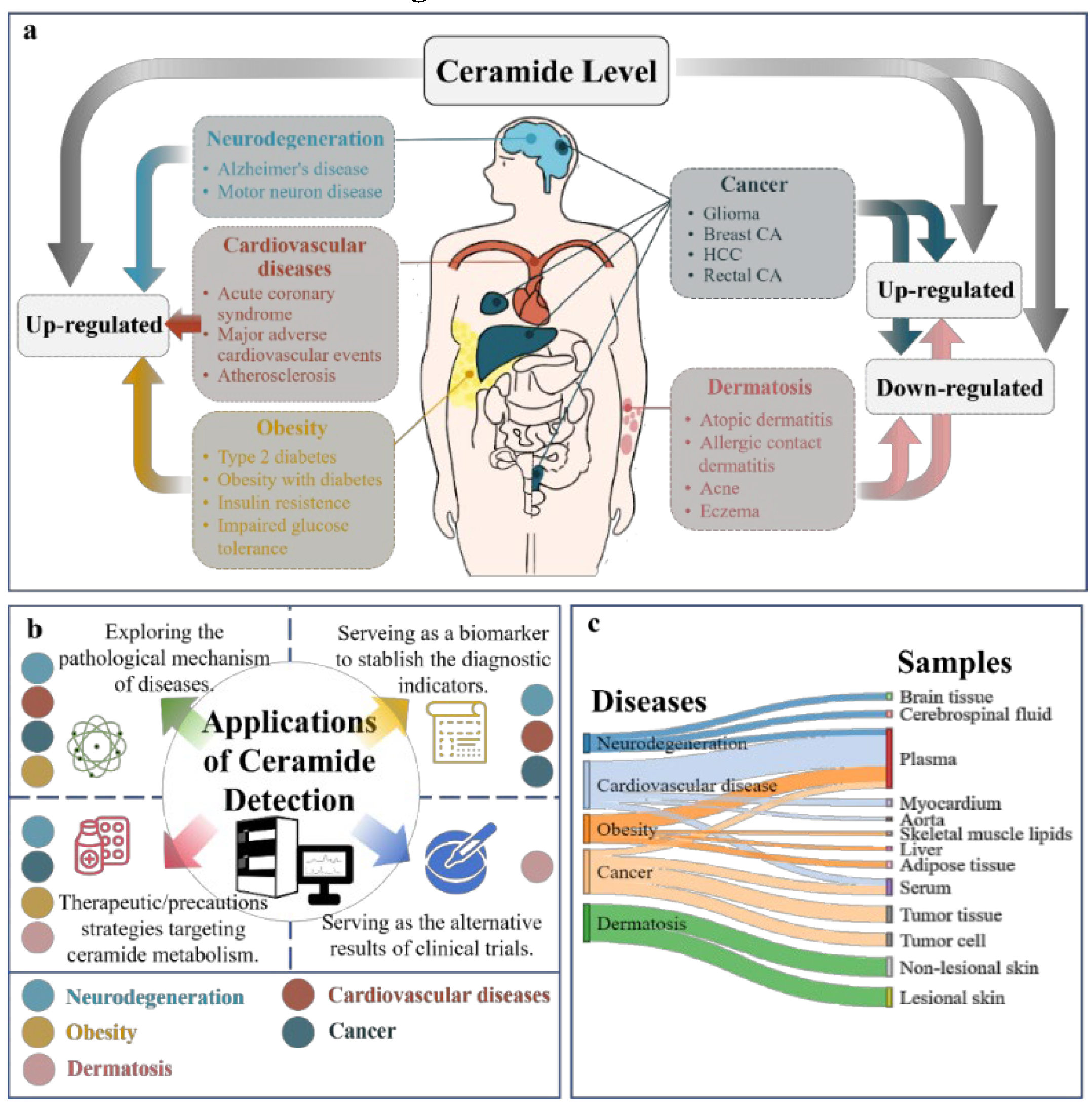 Ceramide as a Promising Tool for Diagnosis and Treatment of Clinical ...