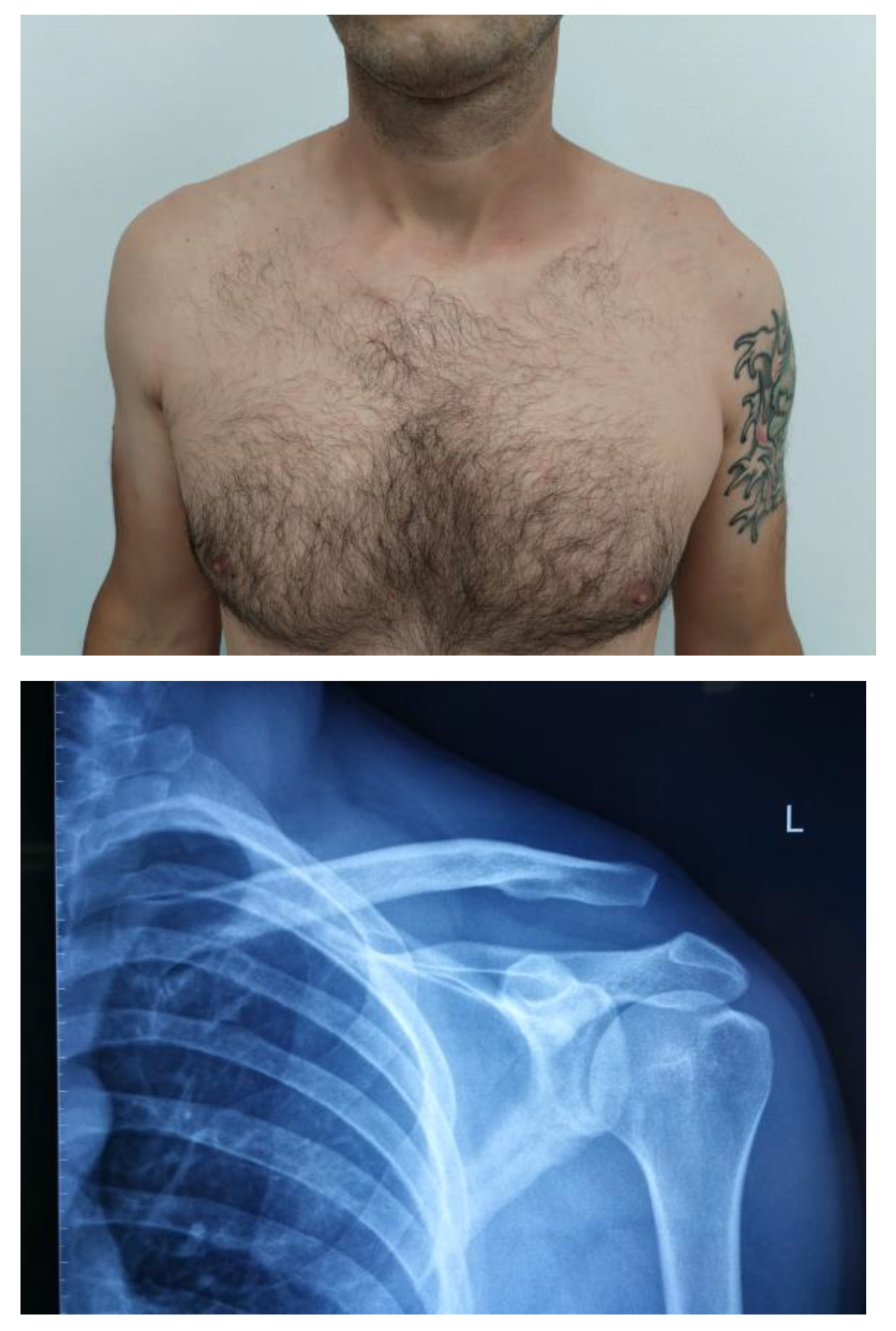 Advantages and Disadvantages of the Arthroscopic Procedure[v1 ...