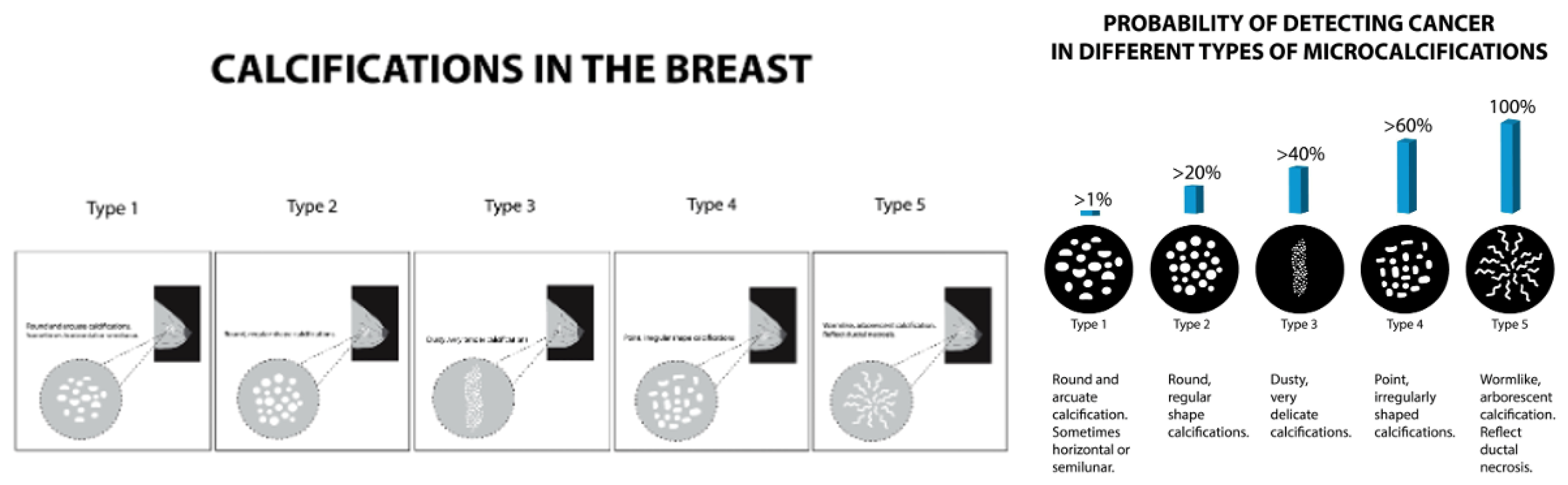 Improving Digital Breast Tomosynthesis: Developing a Novel Phantom for ...