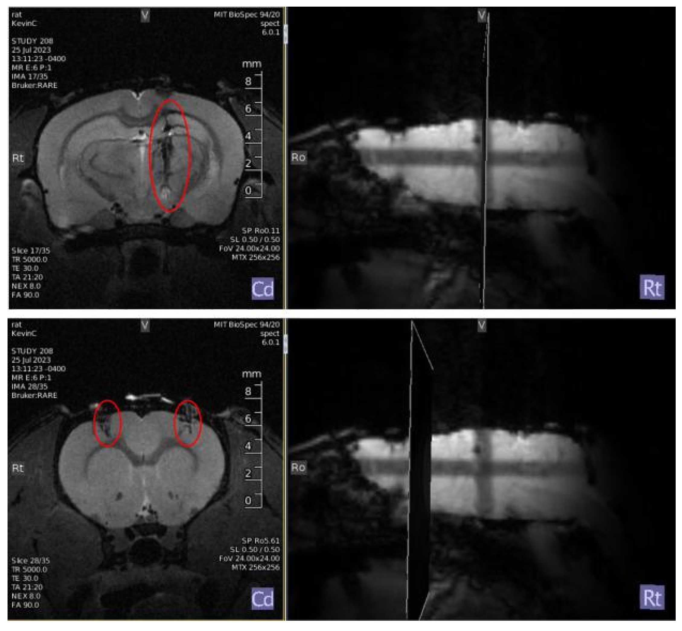 Adaptive Neural Conditioning Using Latent Space Embeddings and Optical Data[v1] | Preprints.org