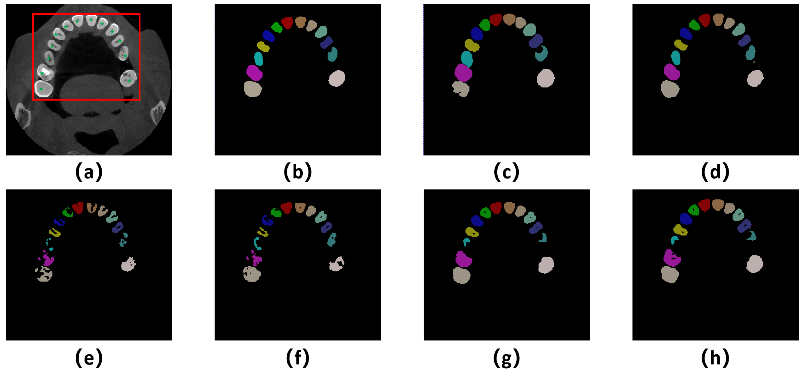 ToothSC-SAM: A Novel Network Model Based on Skip-Connections and SAM for Tooth Segmentation in ...