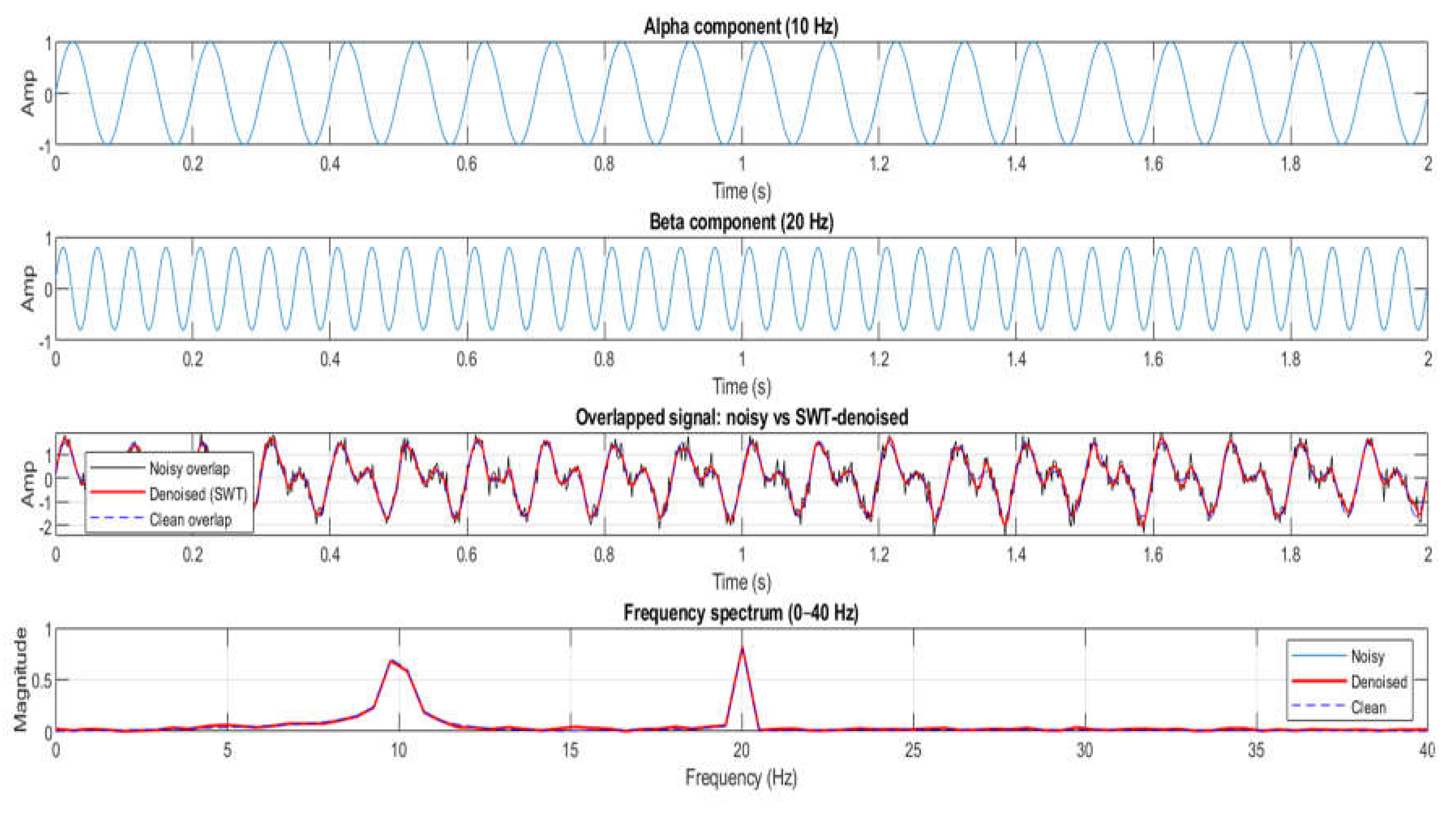 Emotion Recognition in Quadriplegic Patients Using Pharmaco-EEG Signals ...