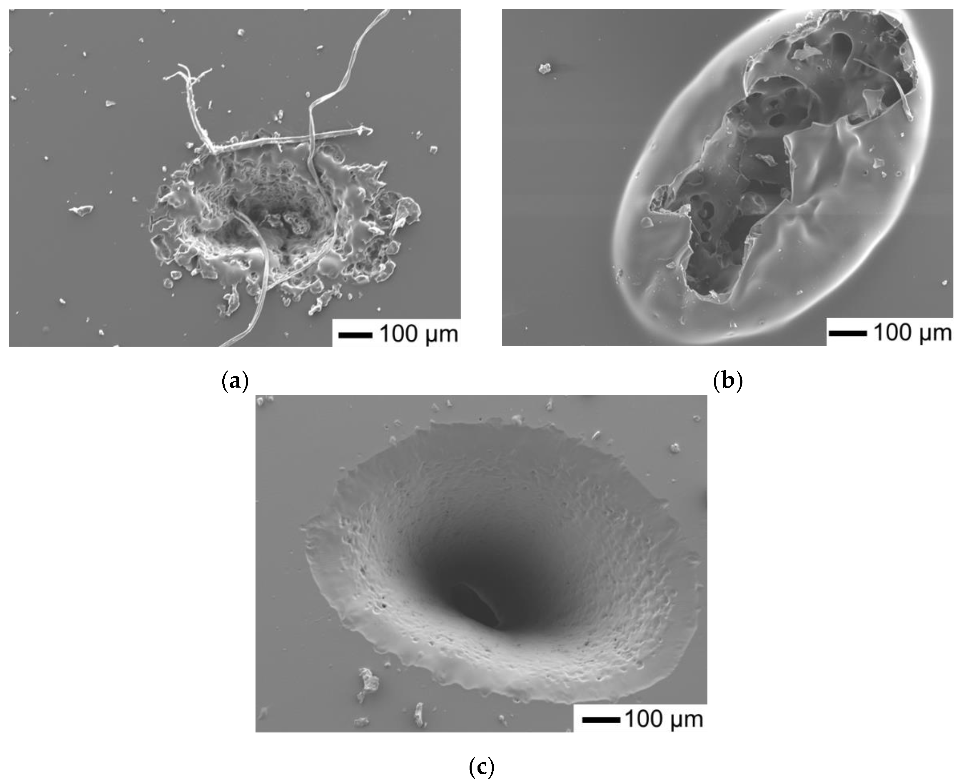 Laser Processing of Intraocular Lenses[v1] | Preprints.org