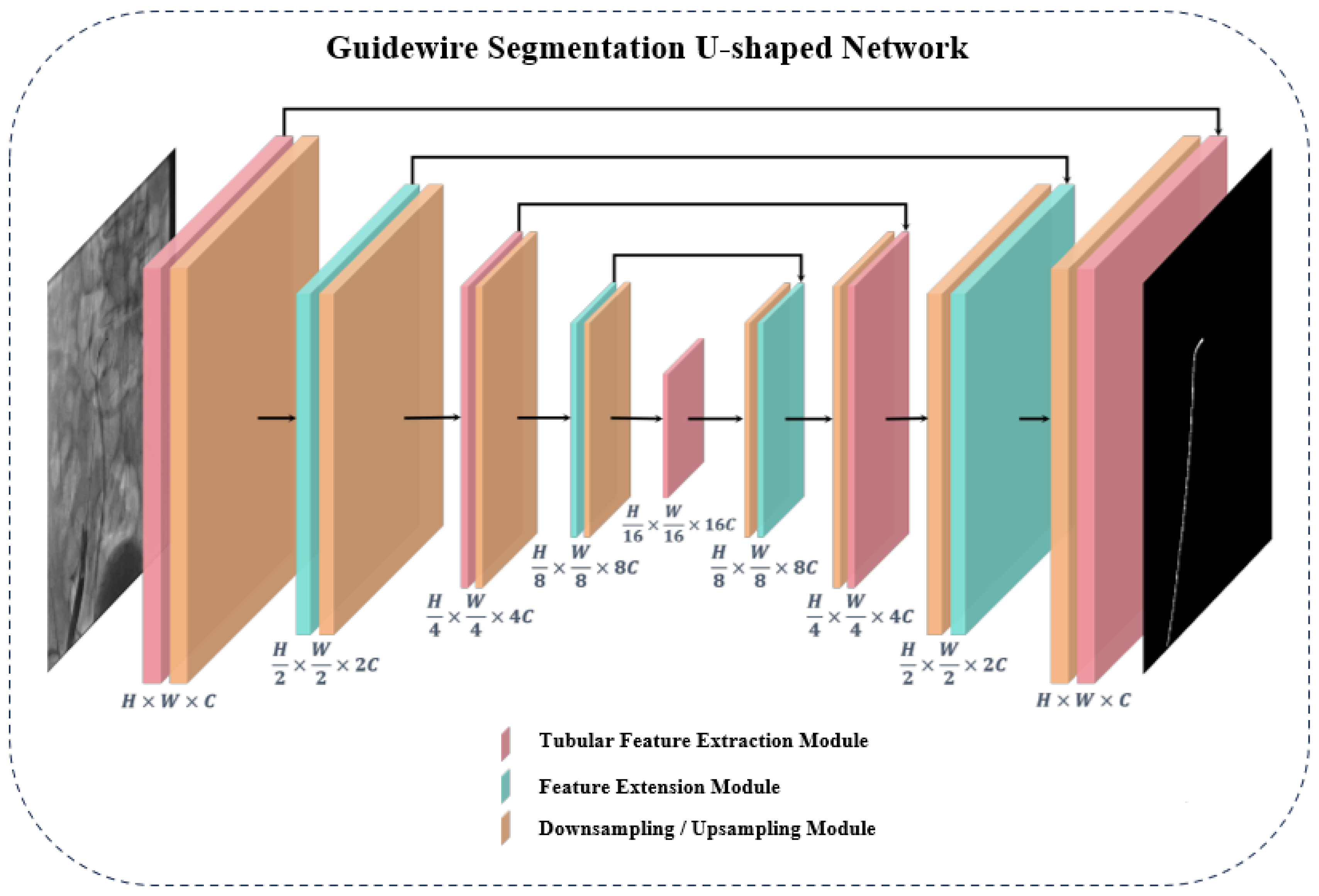 Morphology-Integrated Segmentation for Coronary Interventional Imaging ...