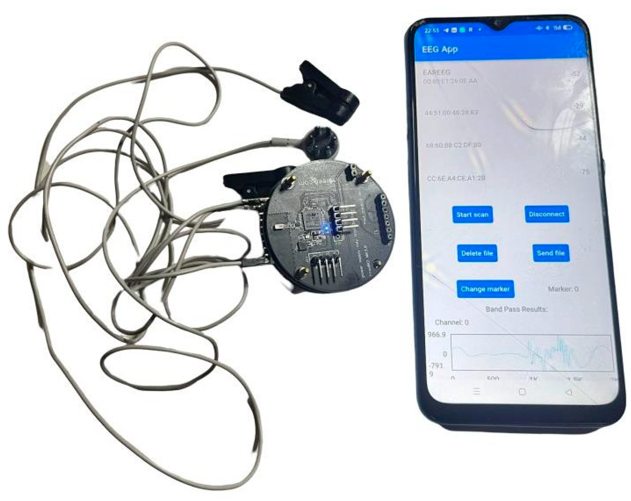 IronBCI: A Low-Cost, Open-Source BCI Platform with Mobile SDK for Rapid Neurotech Prototyping[v1 ...