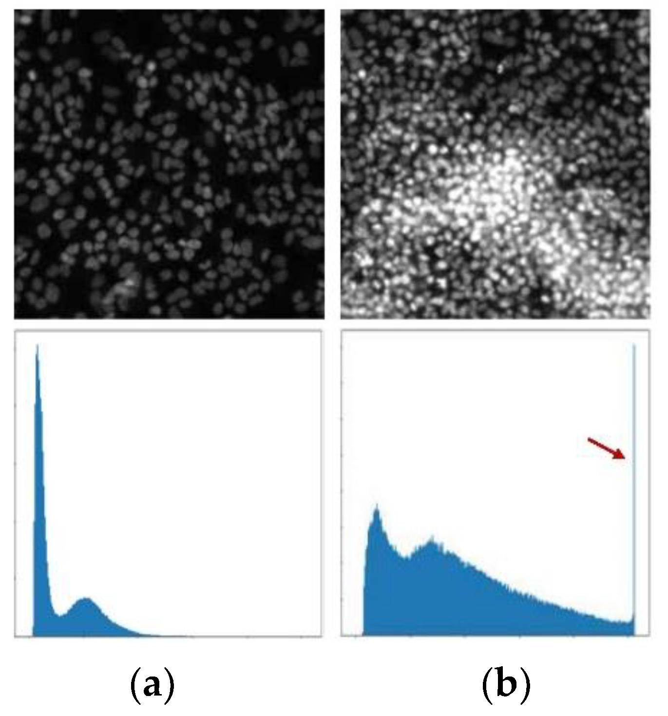 A Saturation Artifacts Inpainting Method Based on Two-Stage GAN for Fluorescence Microscope ...