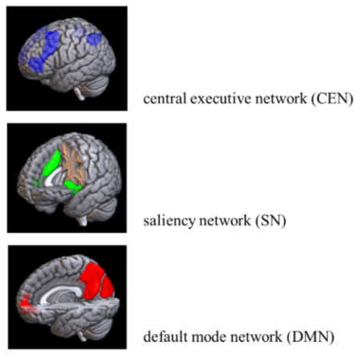 The Relationship between Understanding Diversity and Brain Health, Focusing on the Triple ...