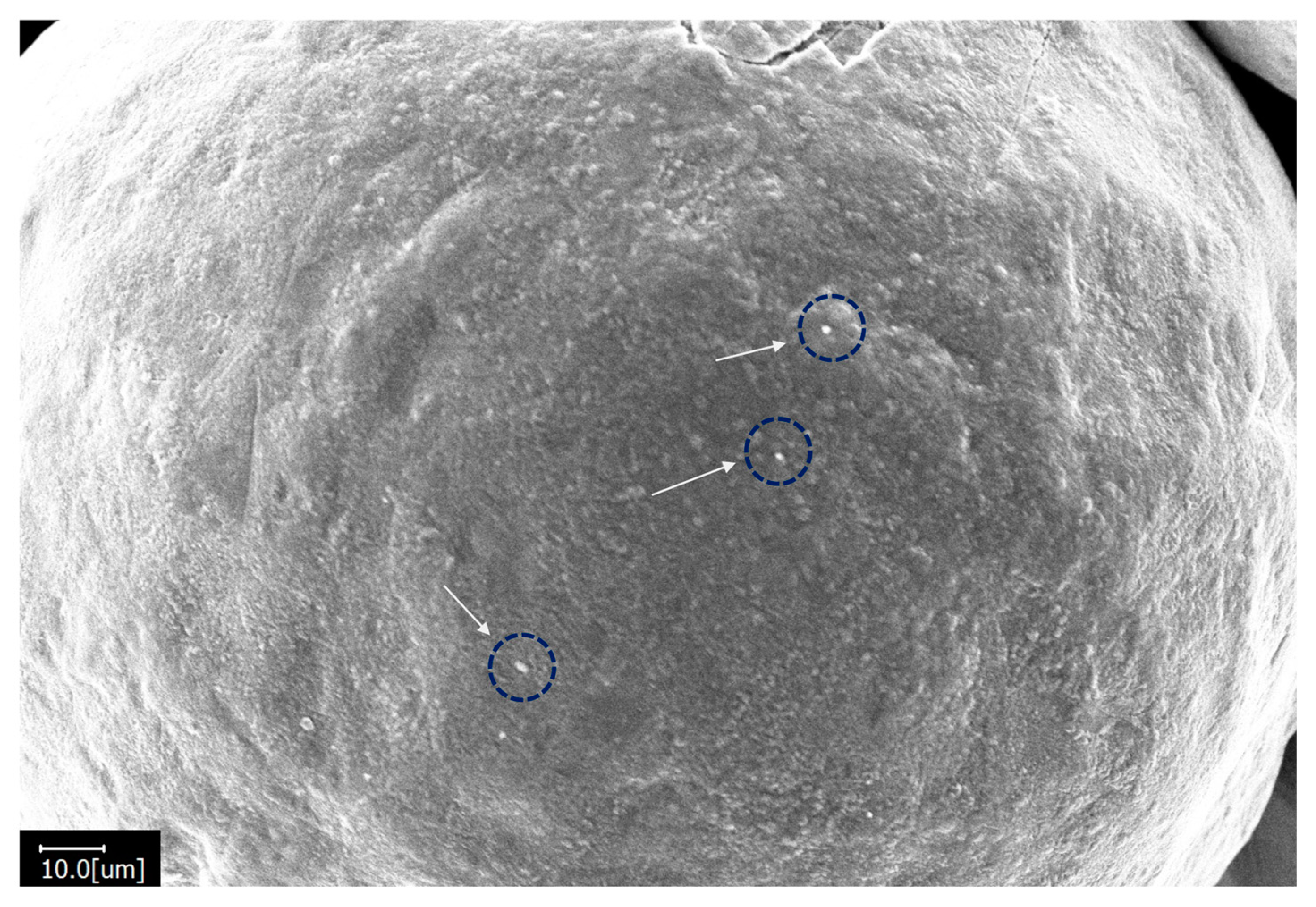 Effect of N/O Elements on Microstructure and Mechanical Properties of ...