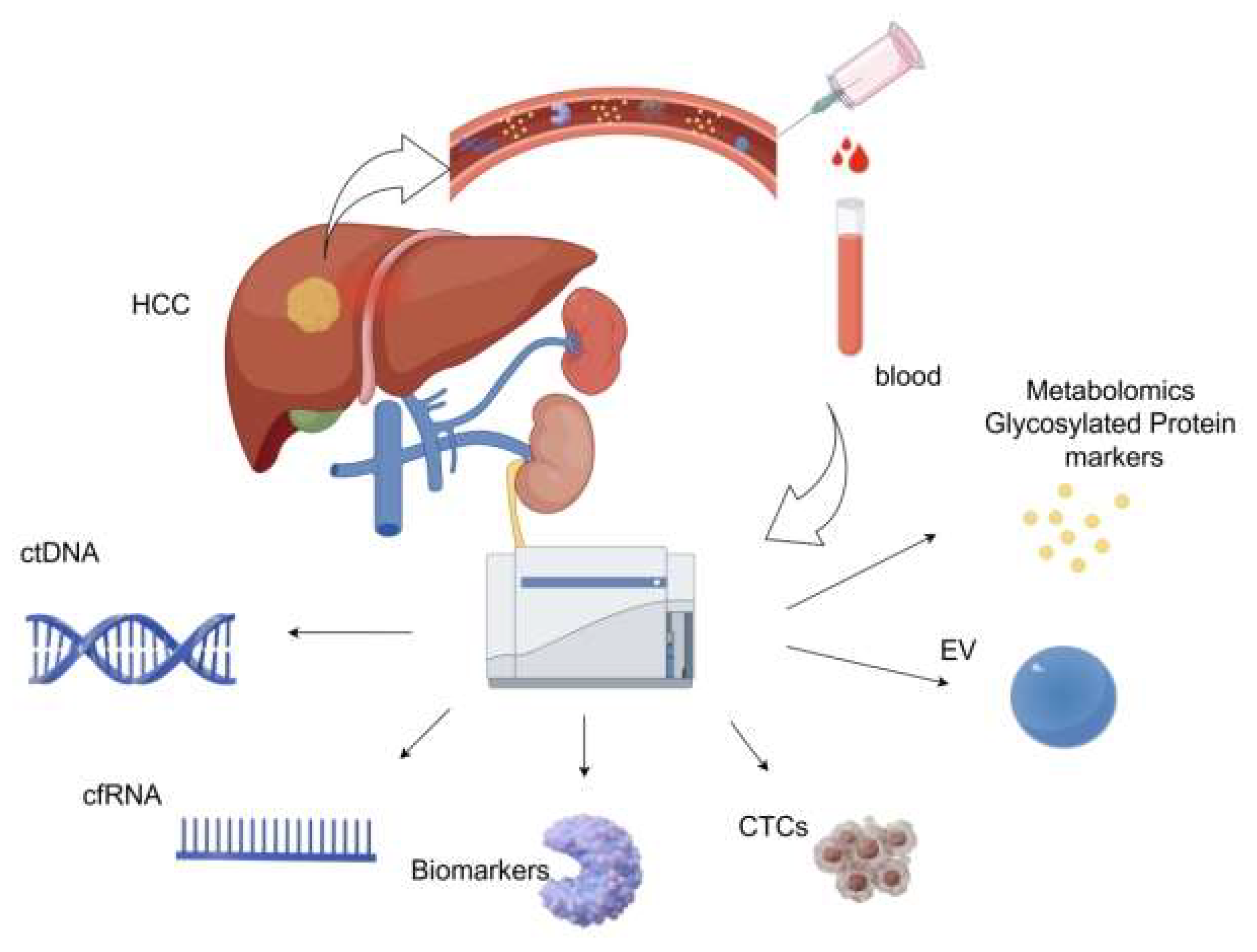 New Insights into the Diagnosis and Treatment of Hepatocellular ...