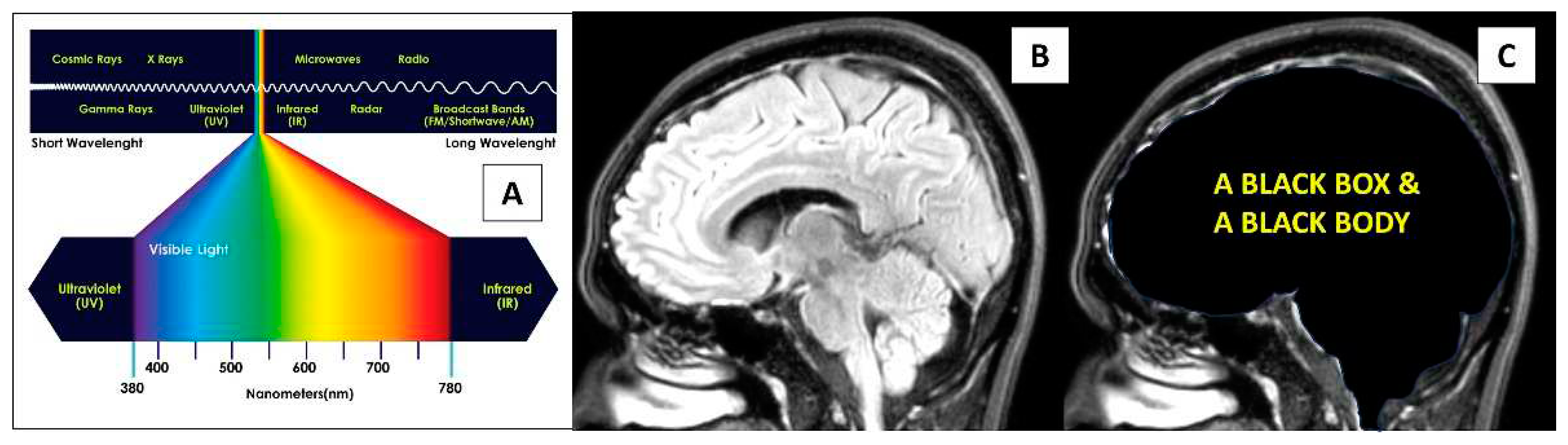 Light and Brain: A Clinical Case Depicting the Effects of Light on ...