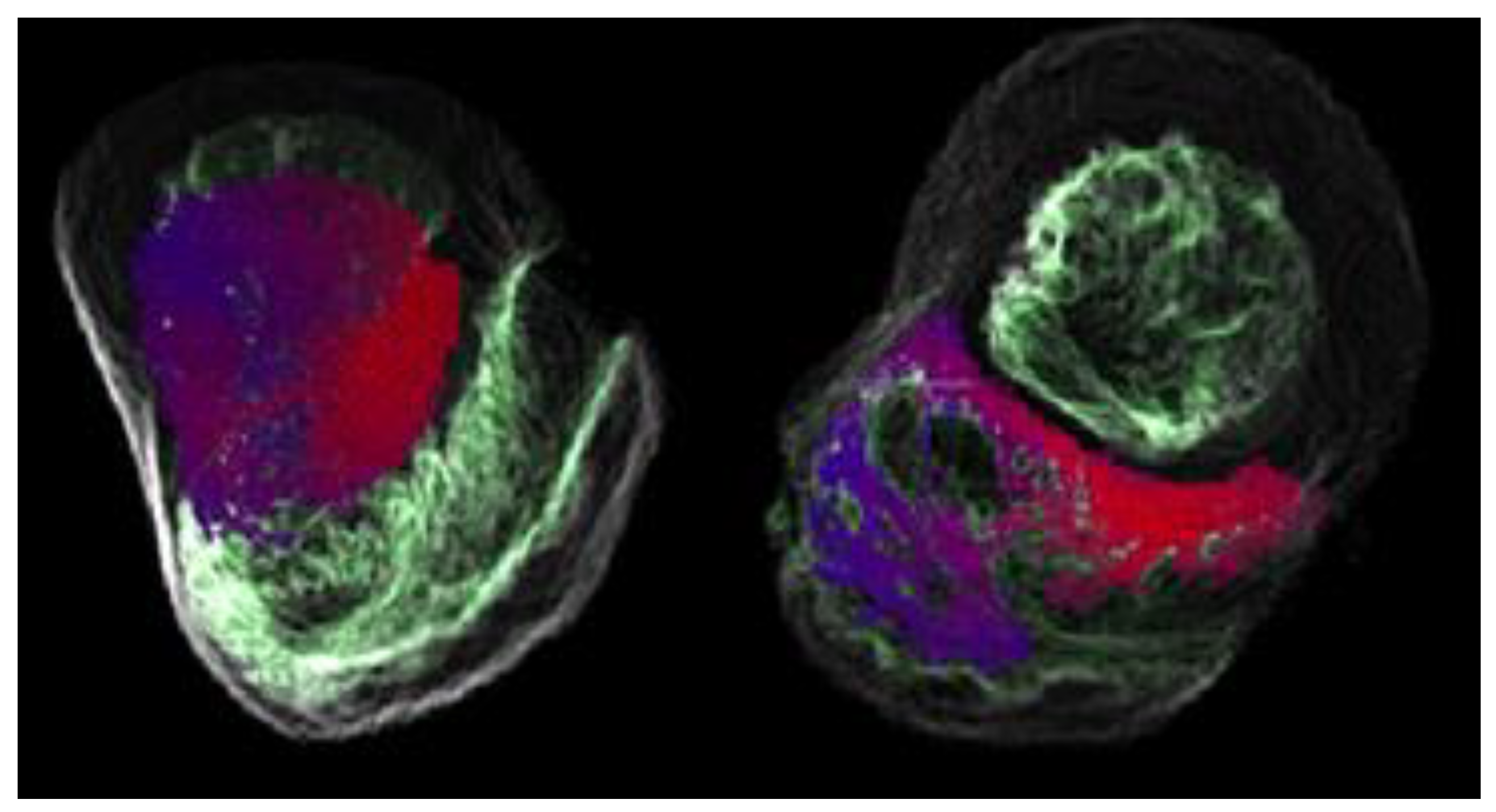 Effect of the Human Heart Material Uniformity on Modeling of the Body ...