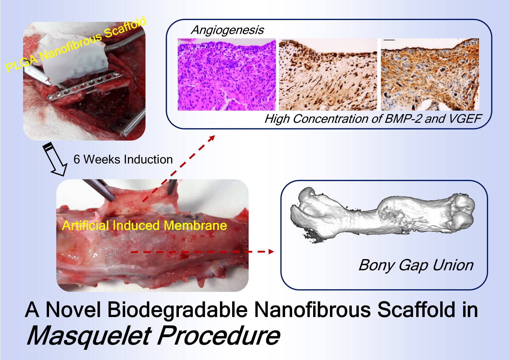 Artificial Membrane Induced by Novel Biodegradable Nanofibrous Scaffold ...