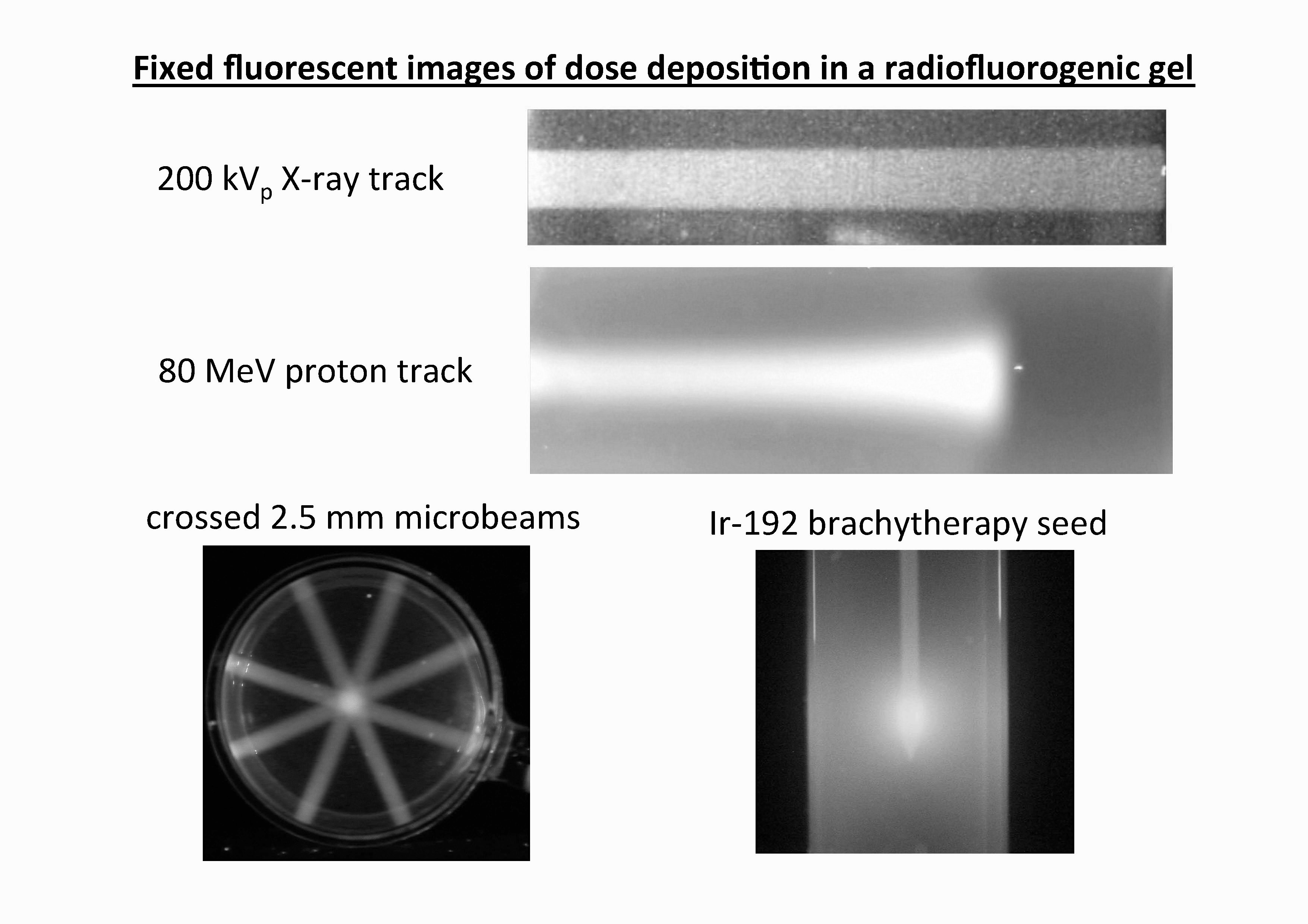 A radio-fluorogenic polymer-gel makes fixed fluorescent images of ...