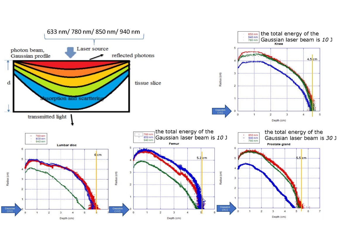 Simulating Low-Level Laser Propagation From Skin Surface To Lumbar Disc ...