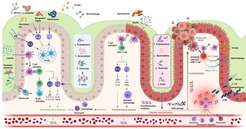 Microbiota-Immune Interactions in Ulcerative Colitis and Colitis ...