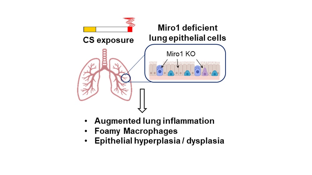 Epithelial Ablation of Miro1/Rhot1 GTPase Leads to Mitochondrial ...