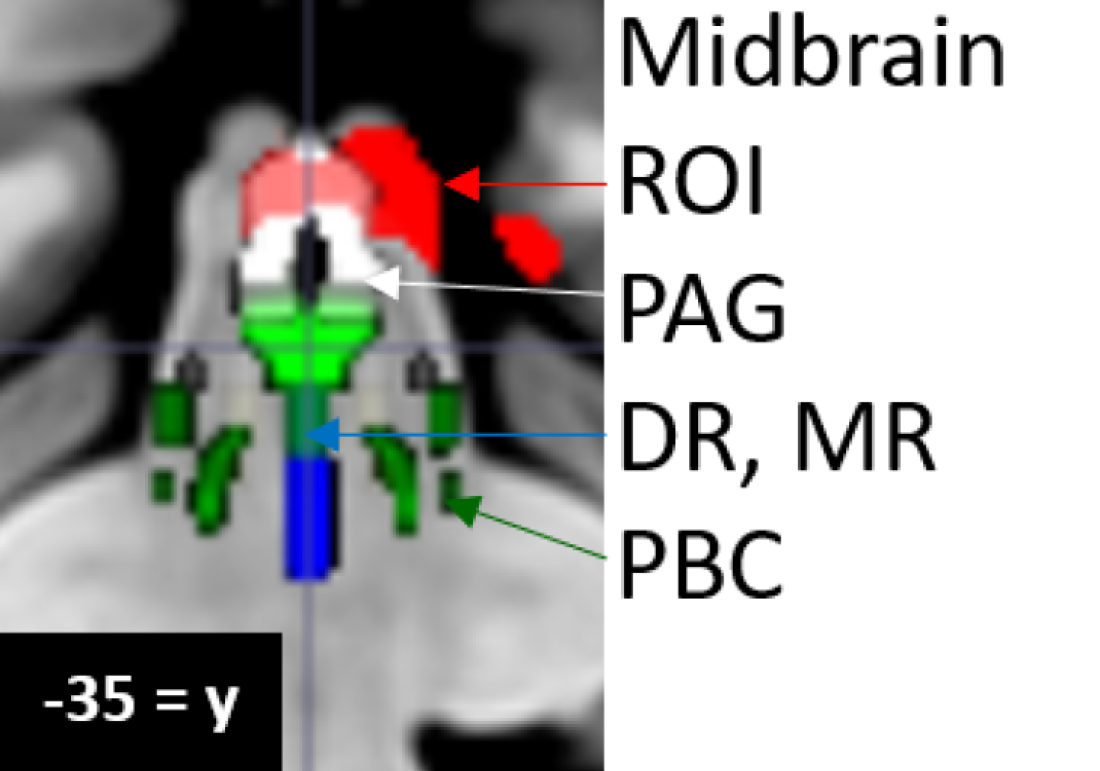 Differential Effects of Exercise on fMRI of the Midbrain Ascending ...