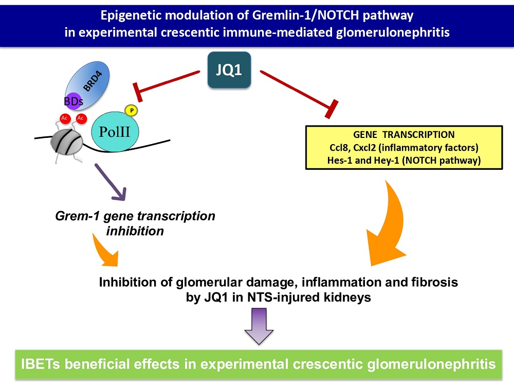 Epigenetic Modulation of Gremlin-1/NOTCH Pathway in Experimental ...