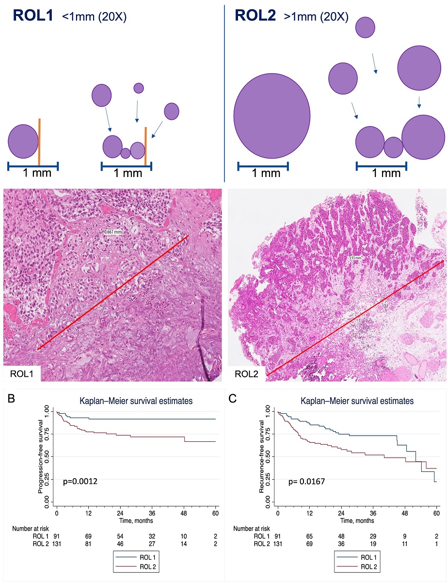 Prospective Validation of the ROL System in Substaging Pt1 High-Grade ...