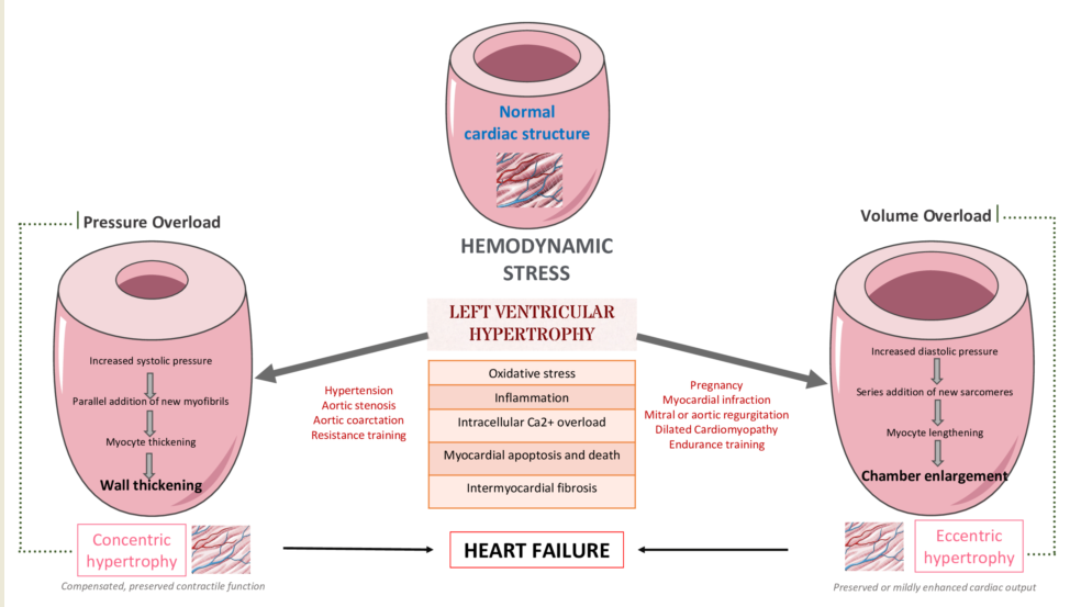 Exercise Effects on Left Ventricular Remodeling in Patients With ...