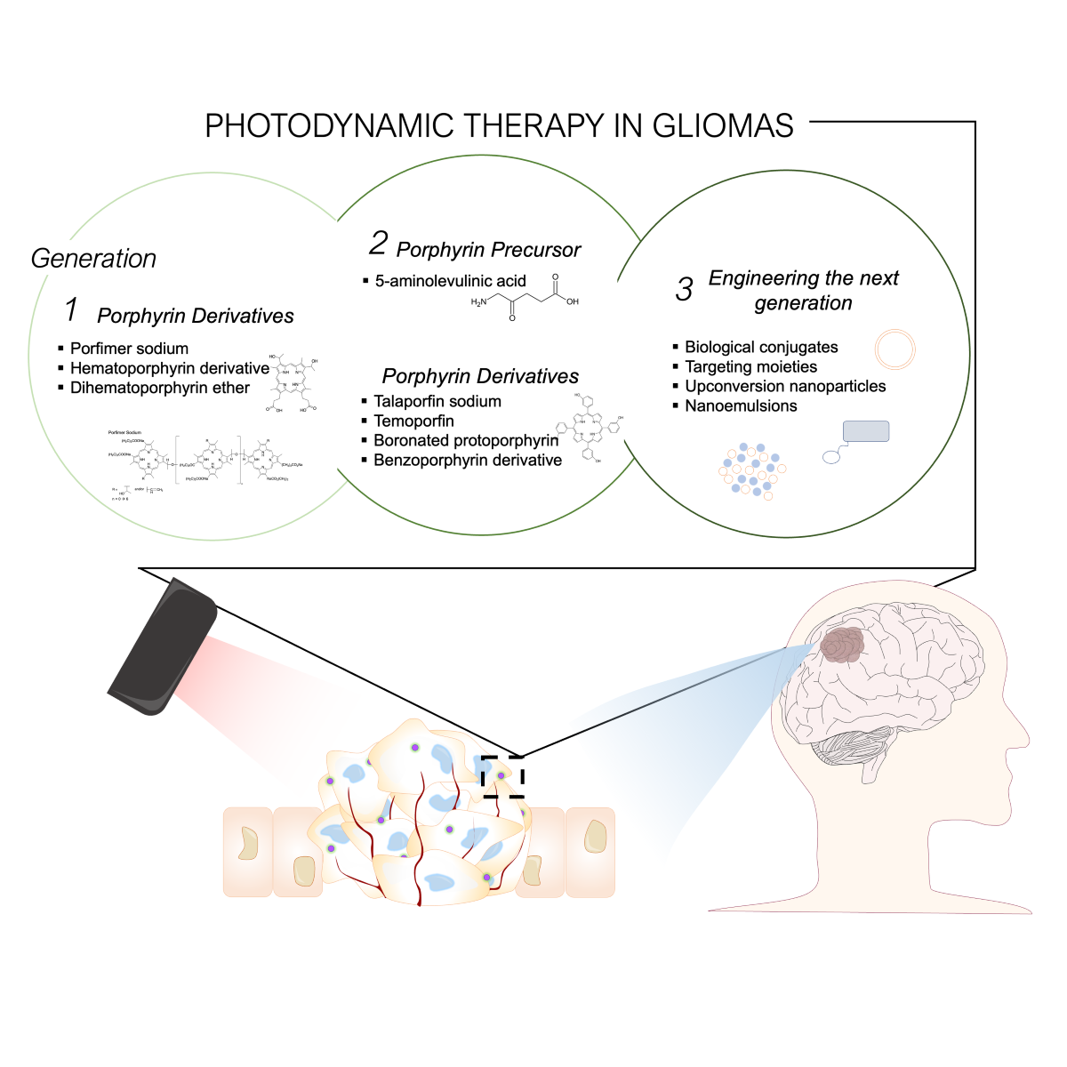 Systematic review of photodynamic therapy in gliomas[v1] | Preprints.org