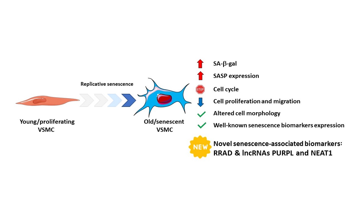 Replicative Senescence in Vascular Smooth Muscle Cells: PURPL and NEAT1 ...