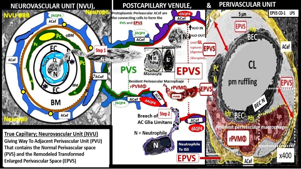 Protoplasmic Perivascular Astrocytes Play a Crucial Role in the ...