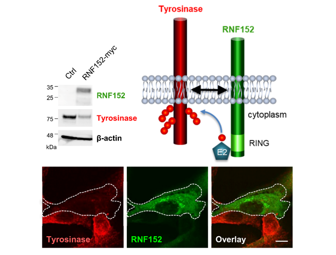 Membrane-Associated Ubiquitin Ligase RNF152 Orchestrates Melanogenesis ...