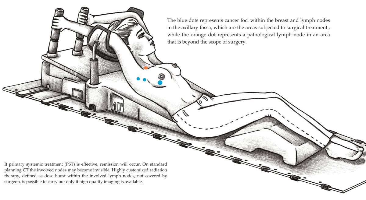 Baseline Computed Tomography or Positron Emission Tomography in ...