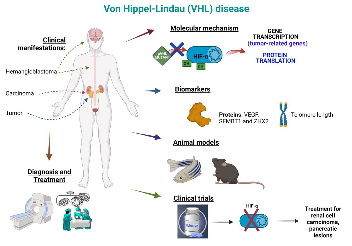 Genetics, Pathophysiology, and Current Challenges in Von Hippel-Lindau ...