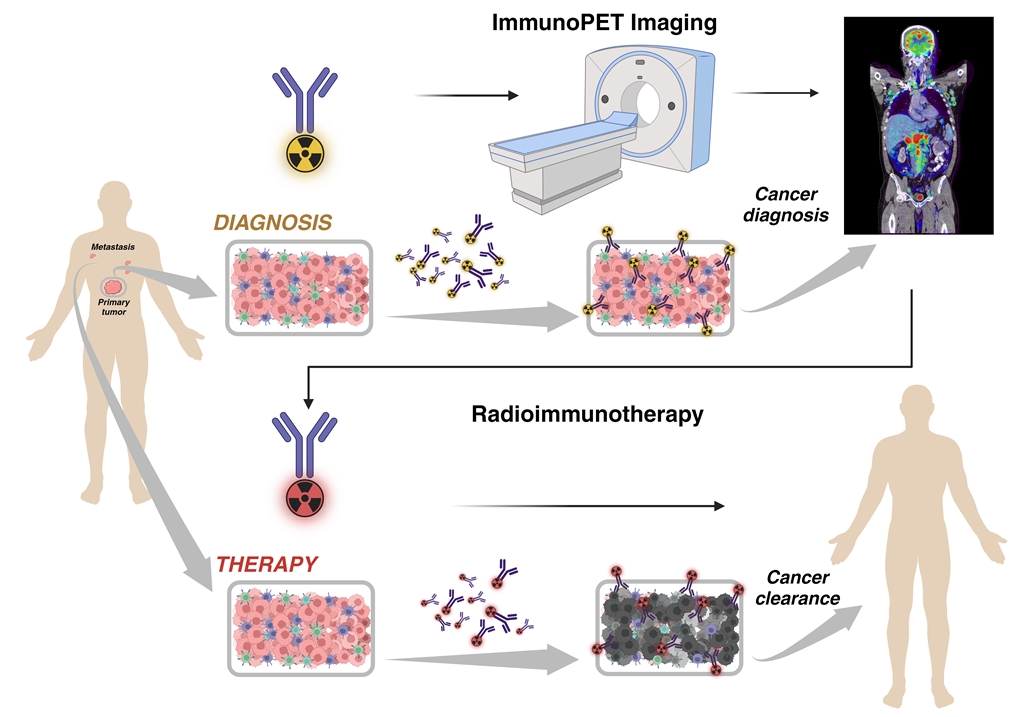 Radioimmunotheragnosis in Cancer Research[v1] | Preprints.org