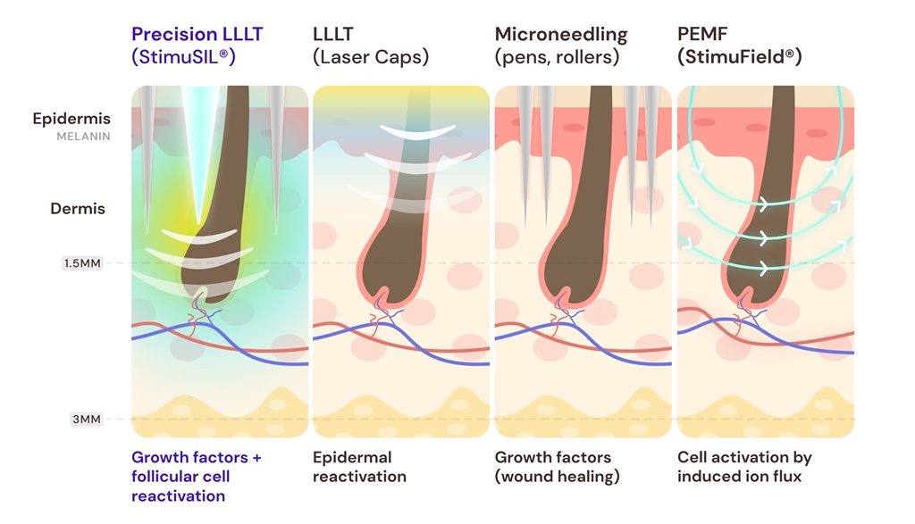 Physical Treatments and Therapies for Androgenetic Alopecia[v1 ...