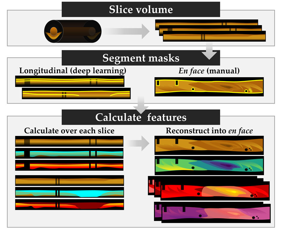 Imaging Biomarkers of Oral Dysplasia and Carcinoma Measured with In ...