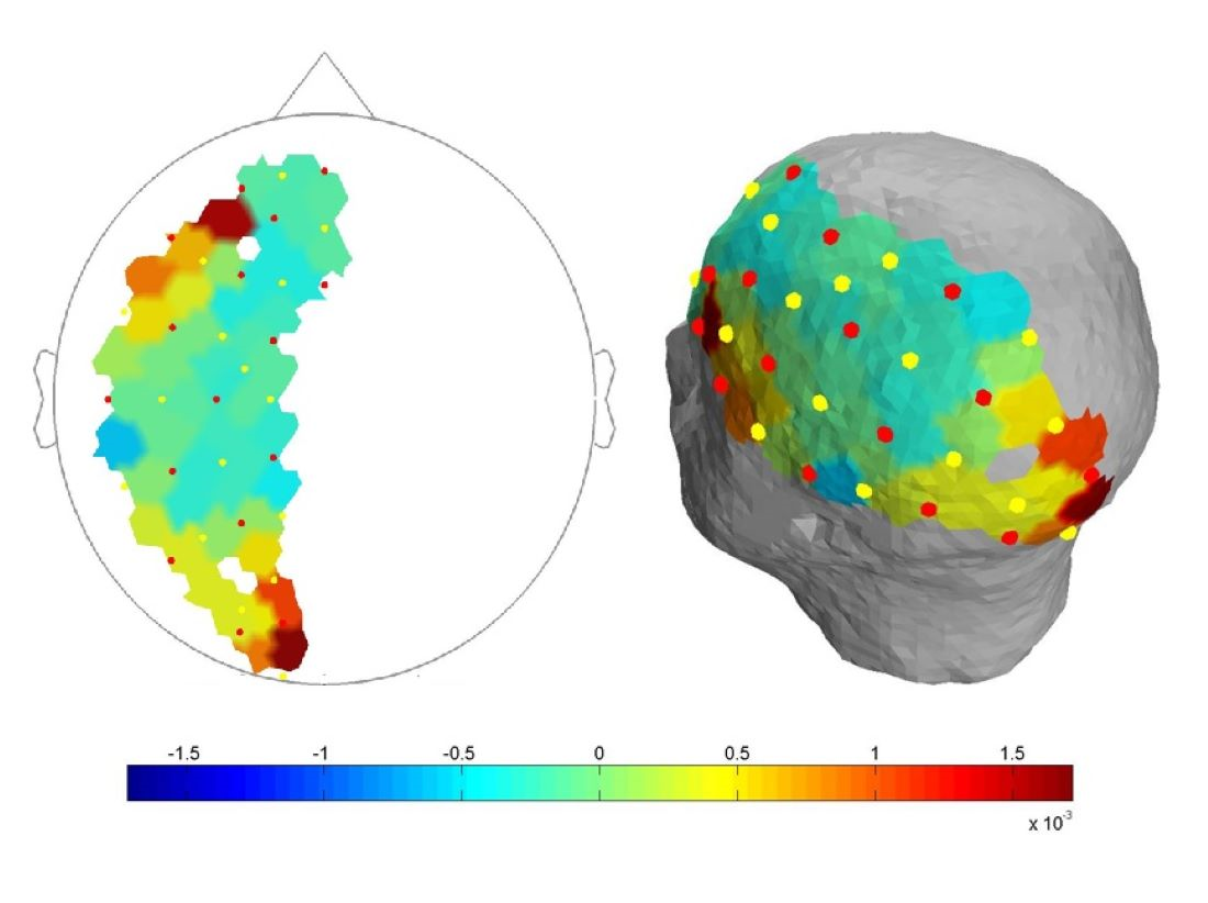 Gustatory-Visual Interaction in Human Brain Cortex: fNIRS Study[v1] | Preprints.org