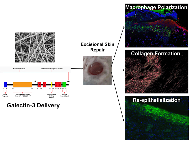 Assessment of Wound Bed Delivery of Galectin-3 to Modulate Macrophage ...